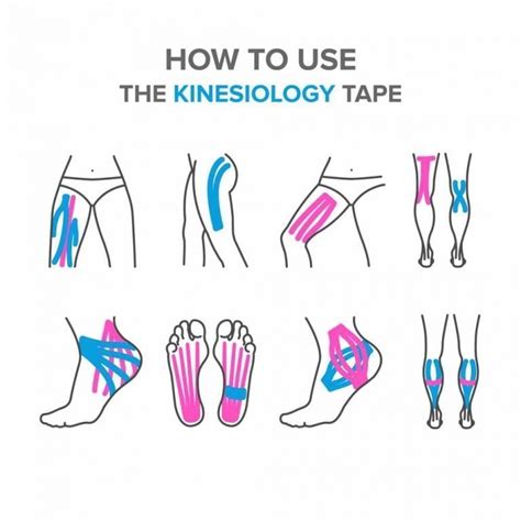 A Complete Guide On Plantar Fasciitis Taping Methods