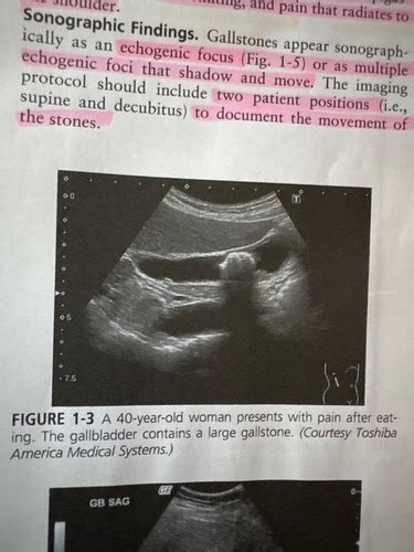 Medical And Surgical Diseases Midterm Flashcards Quizlet