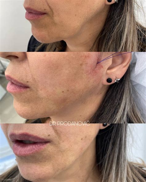 Dr Srdjan Prodanovic Home Facebook