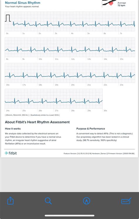 Fitbit Ecg R Readmyecg