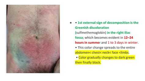 Msc Ivforensic Medicine Thanatologypdf