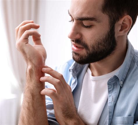 Eczema Bioxcellerator