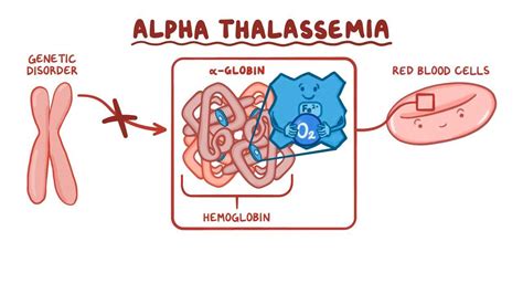 Video Alpha Thalassemia Osmosis
