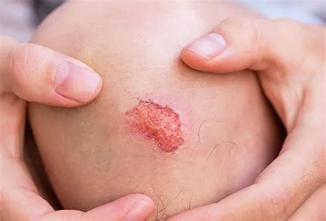 Health Symptoms Causes Treatment Conditions And More