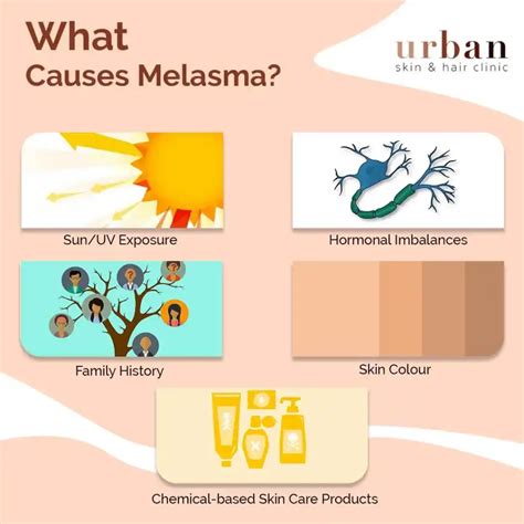 Melasma Treatment Urban Skin And Hair Clinic