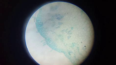 Dicot Root Under Microscope