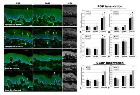 Pgp95 Cutaneous Innervation The Panels Depict Representative