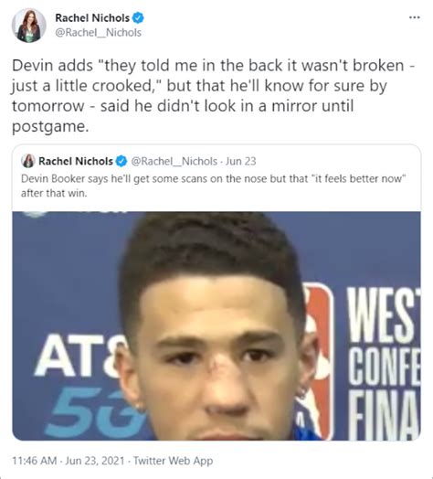 Devin booker broken nose - atiladot