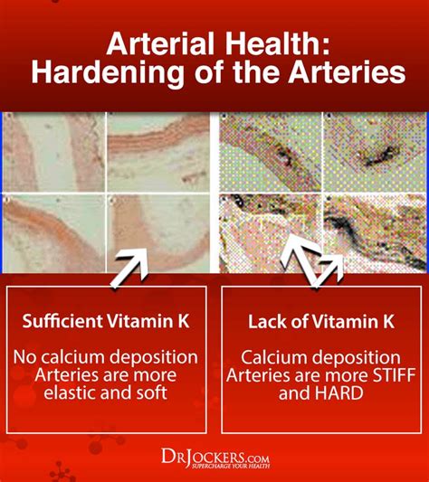 Vitamin K2 Skin Before And After At Timothy Greenwell Blog