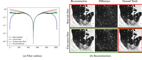 Wnet A Data Driven Dual Domain Denoising Model For Sparse View