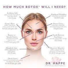 12 Face Map Ideas Botox Injections Facial Aesthetics Botox