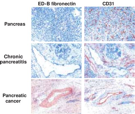 A Specific Expression Of Ed B Fibronectin In Human Tissue Sequential