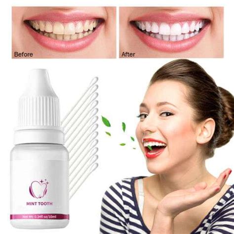 Sparkling White Smile 10ml Tooth Whitening Liquid Cleaner For Radiant
