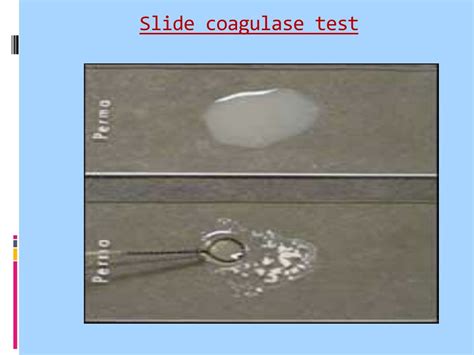Ppt Staphylococcus Infections Virulence Factors And Pathogenesis