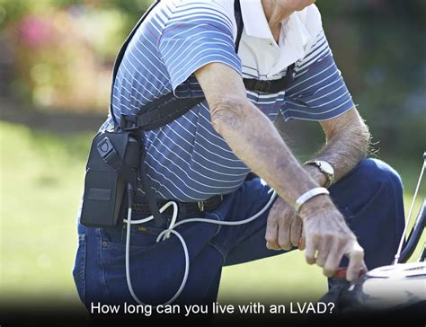 How Long Can You Live With An Lvad Discover The Possibilities Lvad Gear