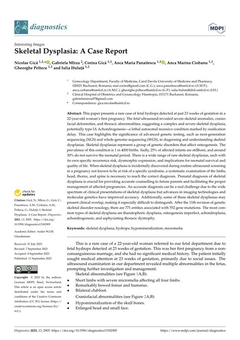 Pdf Skeletal Dysplasia A Case Report