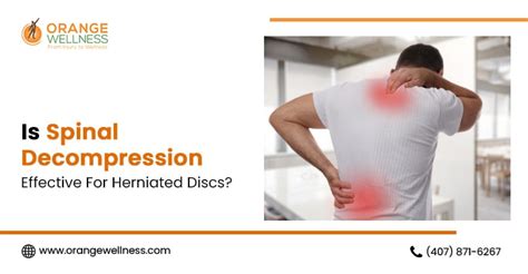 Is Spinal Decompression Effective For Herniated Discs Orange Wellness