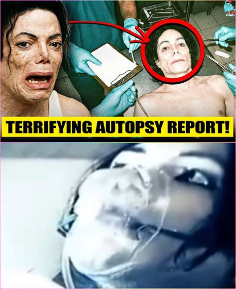 Michael Jackson Autopsy Reveals Horrifying Truth What Really Happened