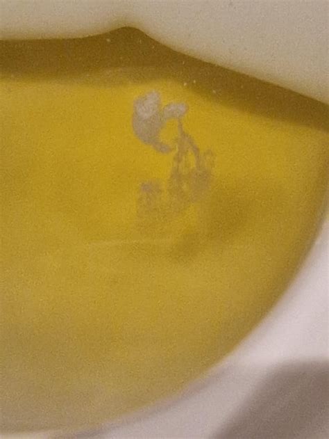 Nsfw Is This Candida In Stool More Info In Comment Section Rcandida