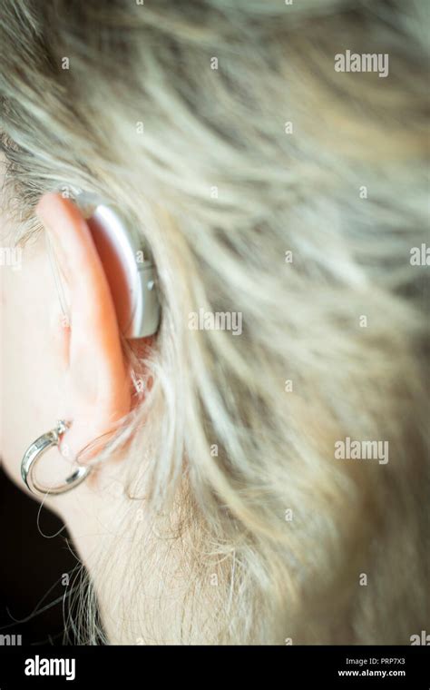 Deaf Lady With Modern Technology Digital Hearing Aid In Her Ear Stock