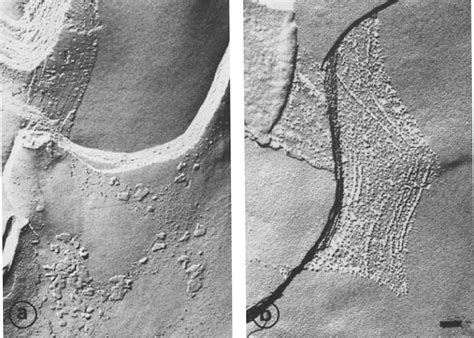 Particle Segregation Occurs In The Cns Much As It Does In The