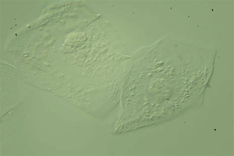 口腔上皮细胞的装片制作方法相差ph显微镜正势利