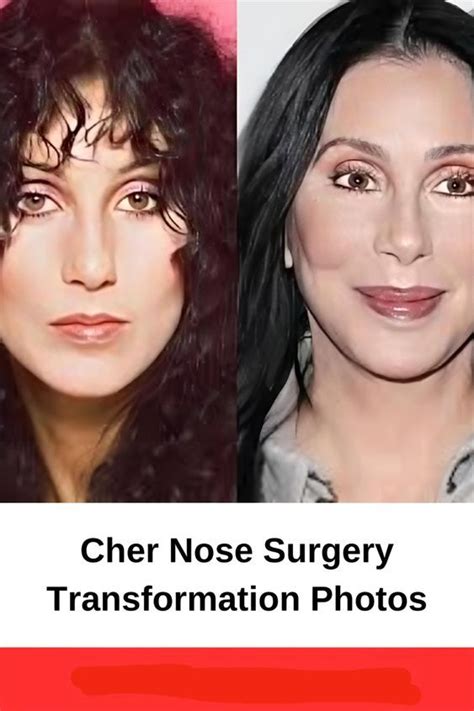 Cher Plastic Surgery Before And After Cher Plastic Surgery Truth
