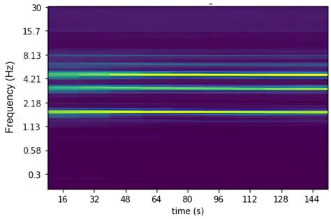 robust heart rate variability measurement from facial videos