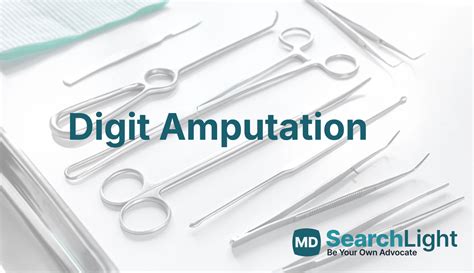 Digit Amputation Md Searchlight