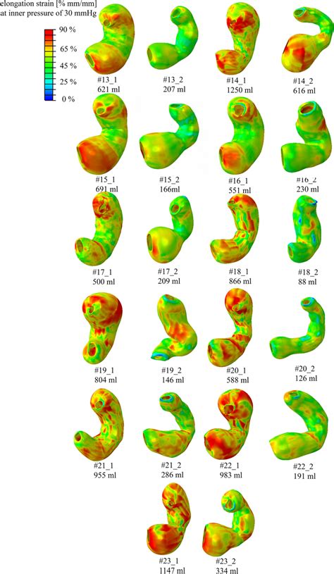 Patients From 13 To 23 Colormaps Of The Distribution Of Elongation