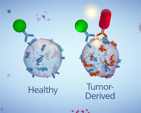 A New Blood Test Could Detect Pancreatic Cancer In The Early Stages Pancreatic Cancer