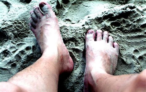 How People With Diabetes Develop Sores On Legs Diabetic Faq