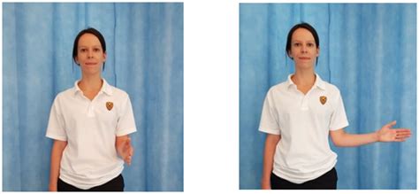 S5 Recurrent Shoulder Dislocation Bedfordshire Hospitals Nhs Trust