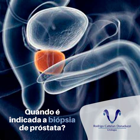 Liquido Saindo Do Penis Fdplearn