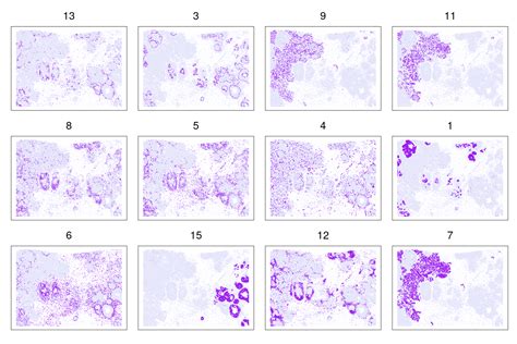 26 Clustering Orchestrating Spatial Transcriptomics Analysis With