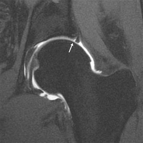 Pelvic Girdle Hip Gluteal Region And Thigh Clinical Tree