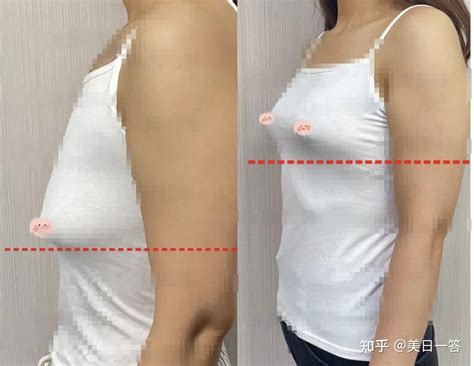 男生会嫌弃女朋友胸下垂吗 知乎