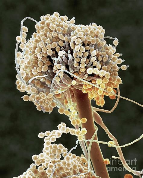 Aspergillus Conidiophores Under Microscope