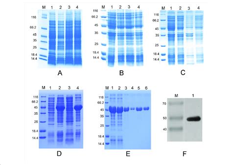 Prokaryotic Expression Analysis Of Various Expression Vectors And