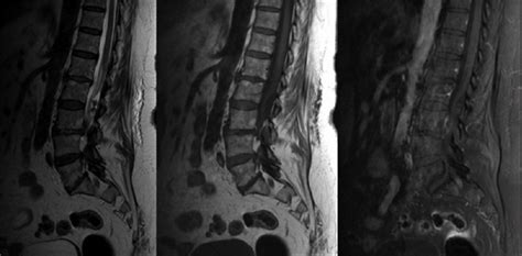 Surgical Neurology International