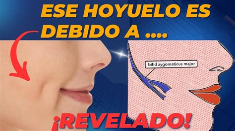 Hoyuelos En Las Mejillas ¿por Qué Se Producen Youtube