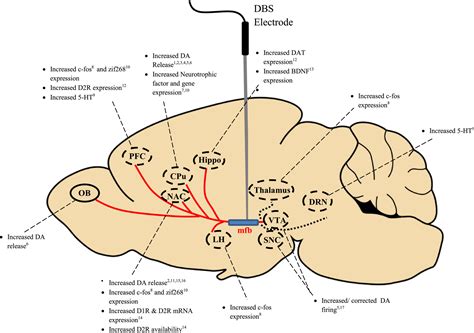 Medial Forebrain Bundle