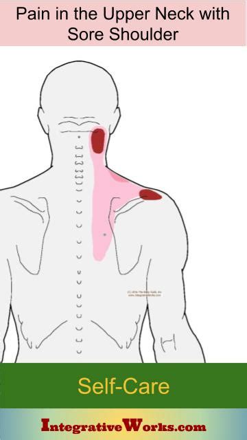 Sore Neck After Lifting Weights Mapageprek