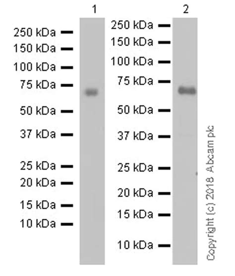 Anti Sox11 Antibody [epr20457] Ab229185 Abcam