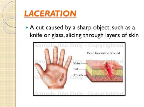 Ppt Cpr And First Aid Powerpoint Presentation Free Download Id2158276