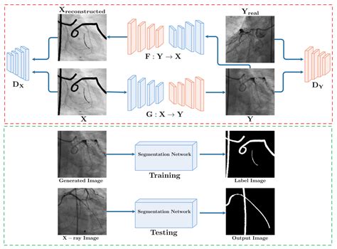 Synthesize And Segment Towards Improved Catheter Segmentation Via