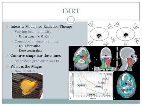 Features Of New Installed Linac Trilogy At Dr Ziauddin Hospital Karac