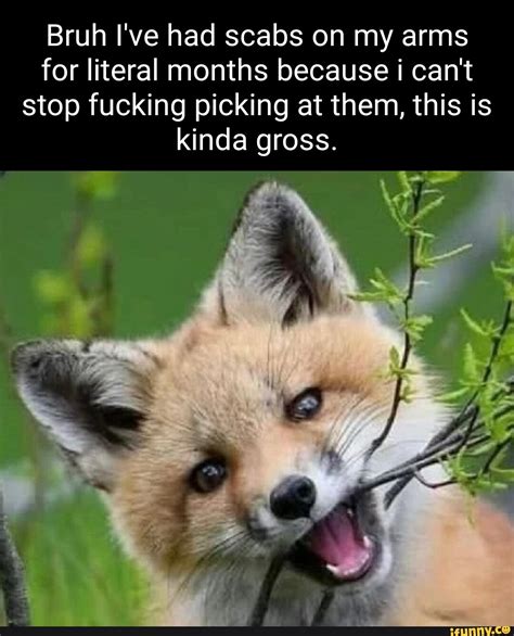 Bruh Ive Had Scabs On My Arms For Literal Months Because Cant Stop