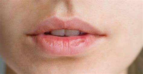 Adi S A Los Labios Secos Remedios Caseros Naturales Para Hidratar Y Potenciar Tu Boca En