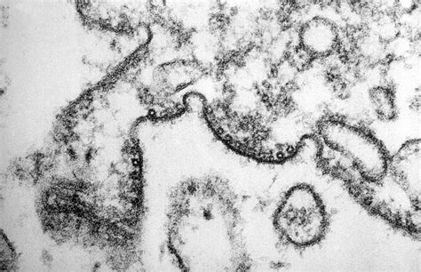 Free Picture Unknown Human Derived Tissue Sample Associated Nipah Virus Infection